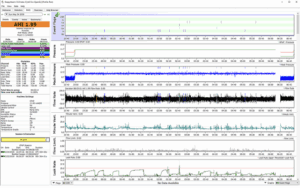 OSCAR CPAP Software - By Jeremy Smith